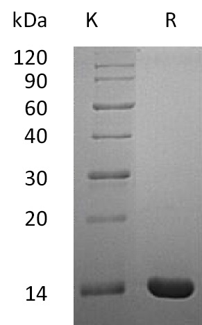IL-2 Protein, Human, Recombinant (E. coli) | TargetMol